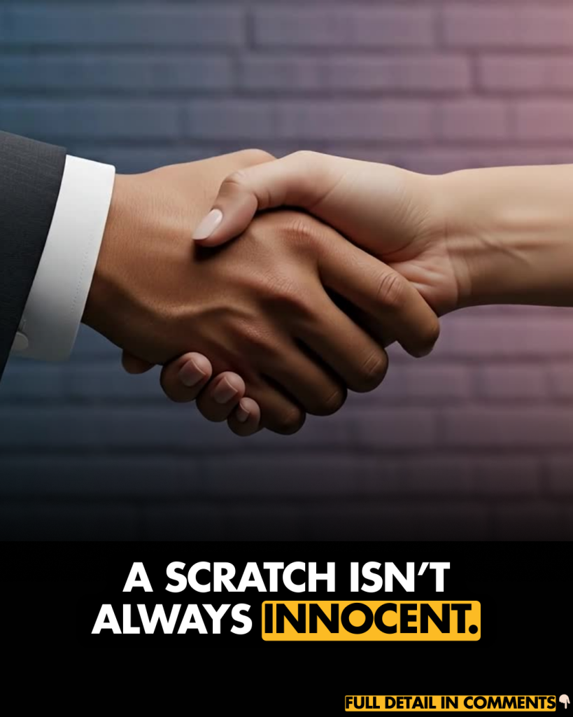 The Meaning Of The Intriguing Gesture Of Scratching The Palm Of Another ...